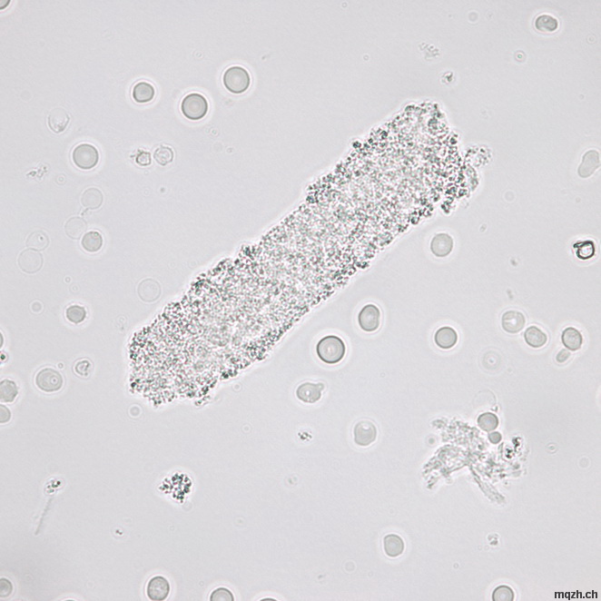 MQ 2012-4 Urinsediment U4
