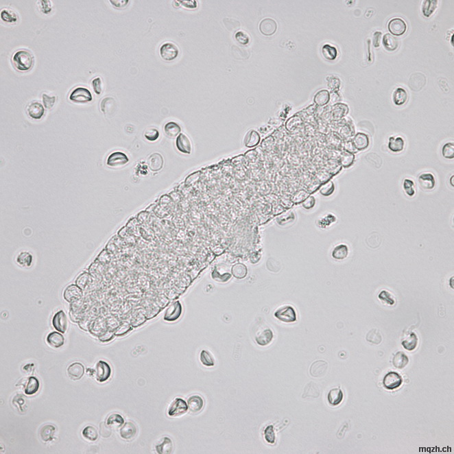 MQ 2012-4 Urinsediment U4