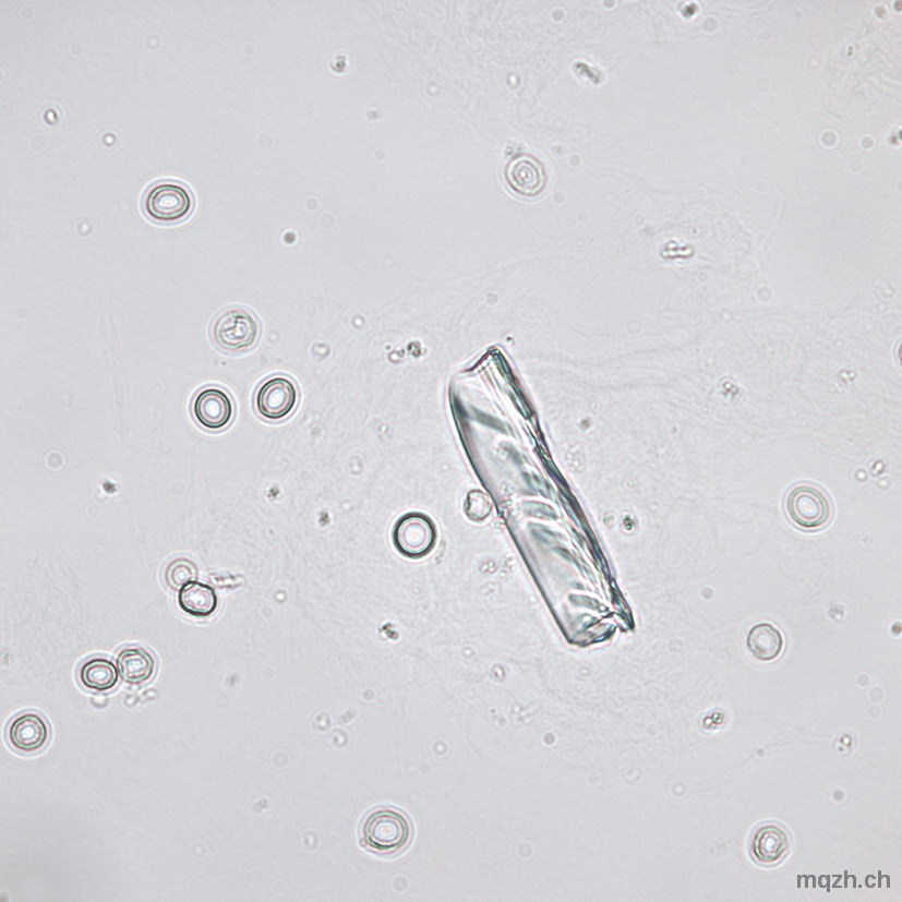 MQ 2013-3 Urinsediment U4