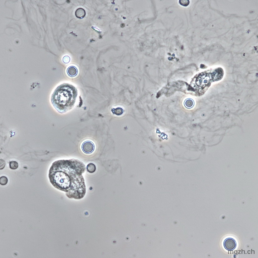 MQ 2013-3 Urinsediment U4